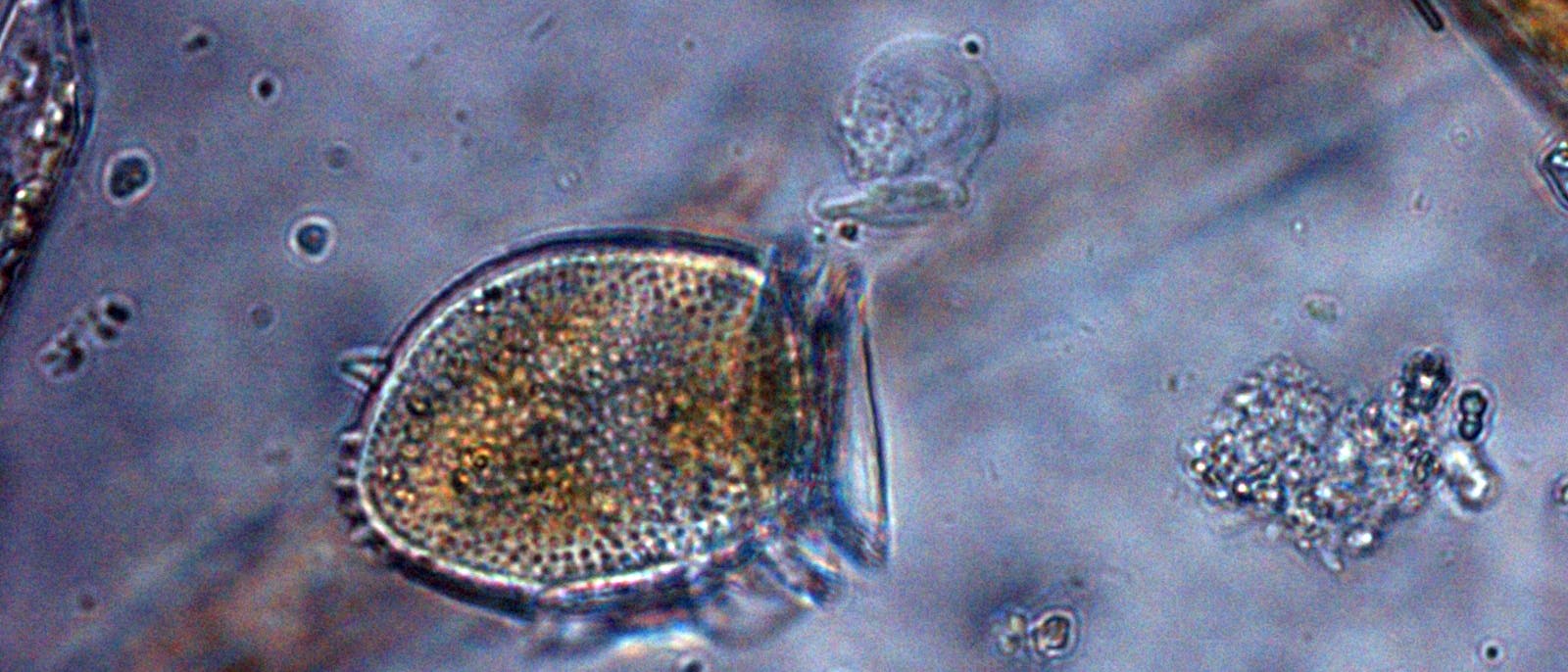 Mixotrophes Plankton: Das Beste aus zwei Welten - Spektrum der Wissenschaft