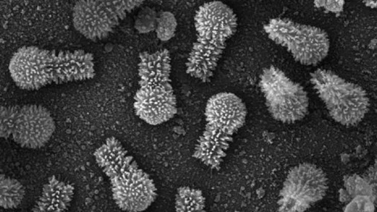 Virologie: Riesenviren sind weiter verbreitet als gedacht - Spektrum ...