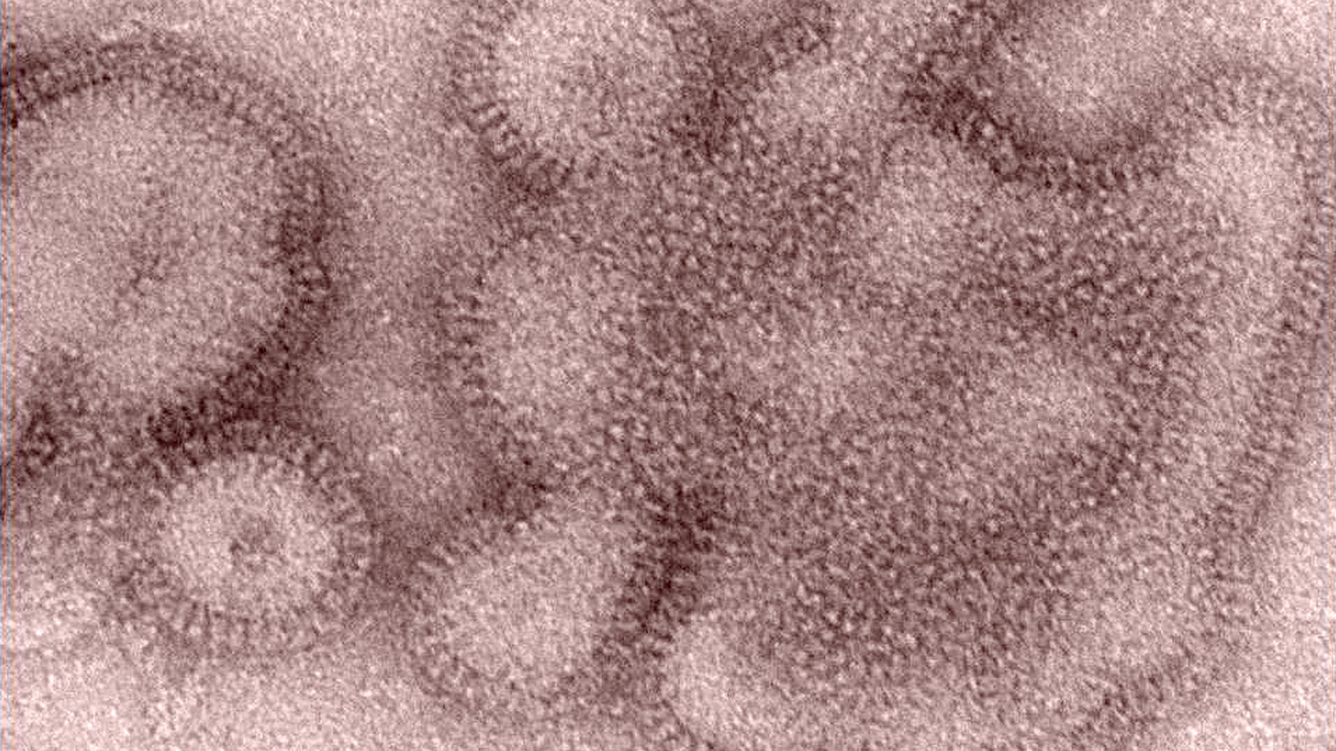 Genregulation: Grippevirus manipuliert epigenetische Regulation der ...