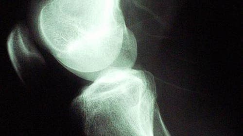 Medizin: Beeinflusst das Knochenmark unser Verhalten? - Spektrum der ...