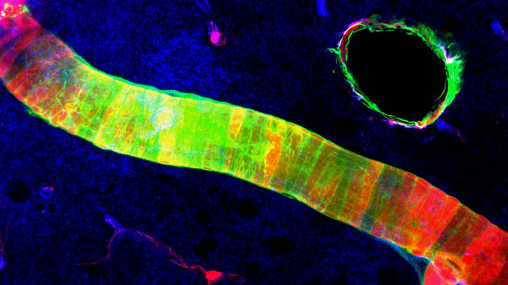 Neurobiologie: Das glymphatische System des Gehirns - Spektrum der ...