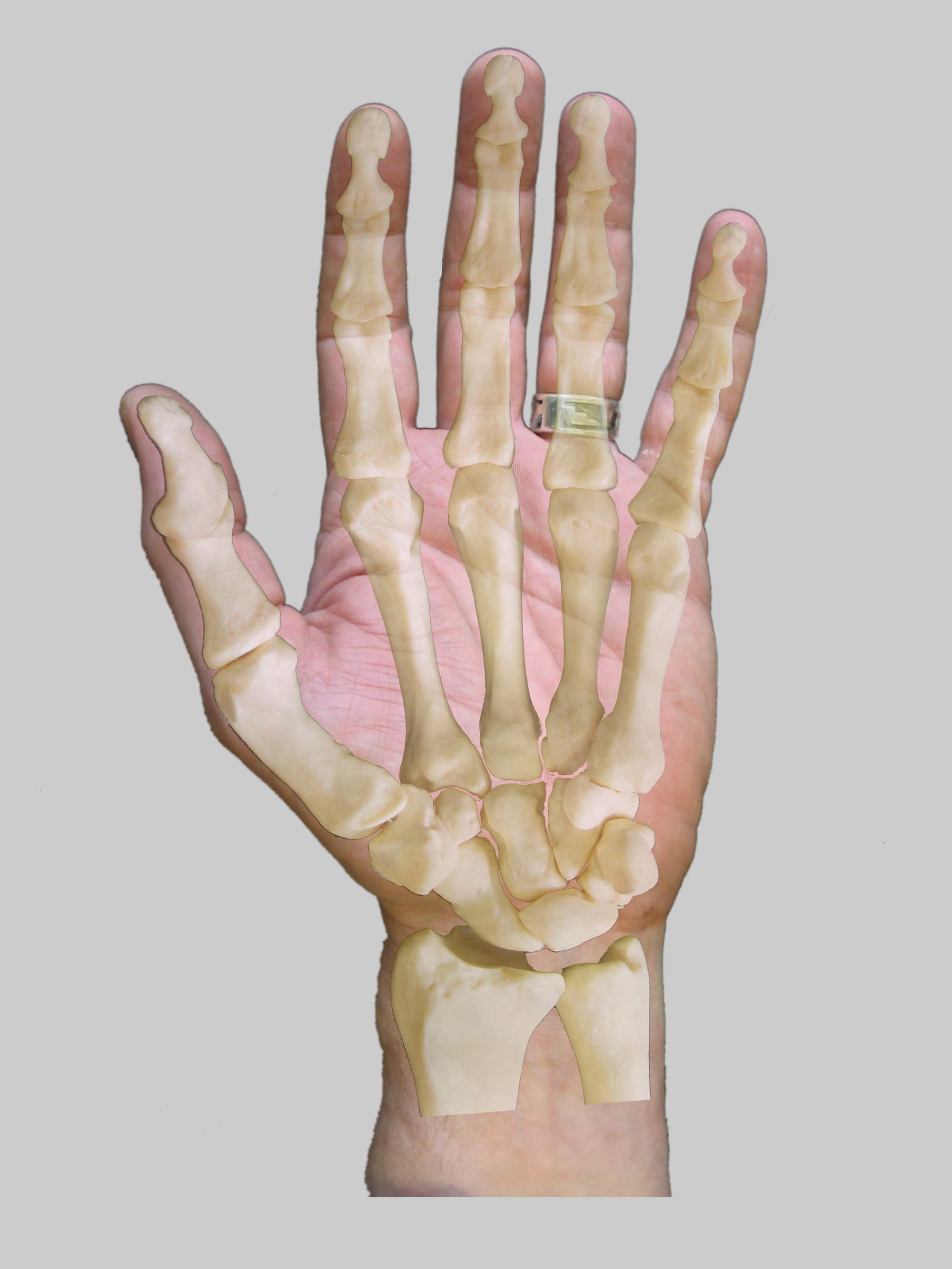 Handwurzelknochen, heiter - Spektrum der Wissenschaft