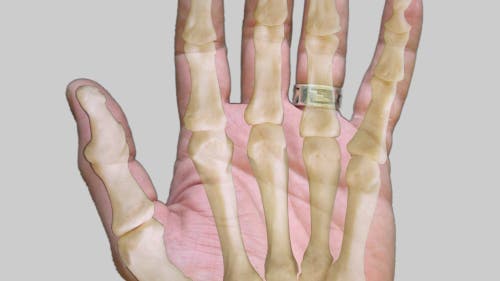 Handwurzelknochen, heiter - Spektrum der Wissenschaft