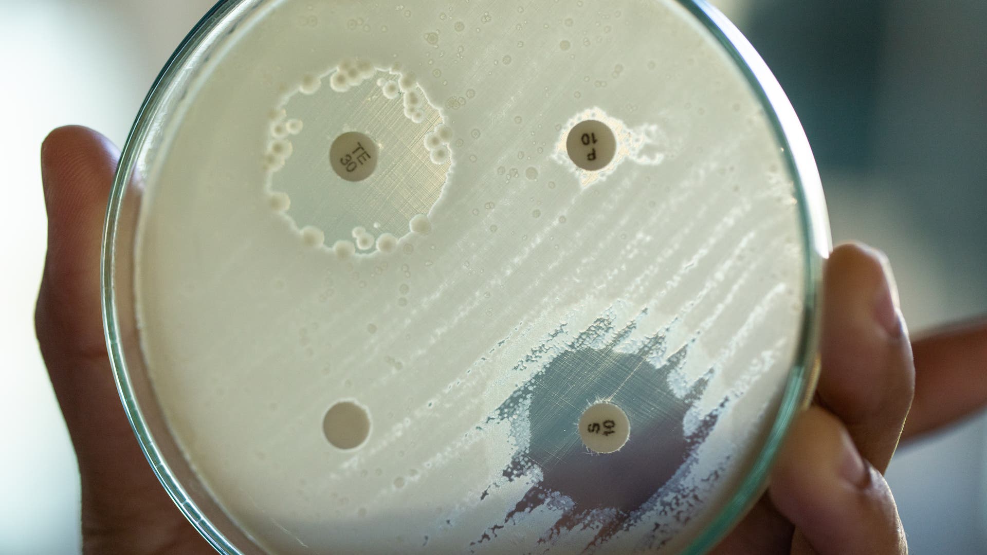 Multiresistente Erreger: Antibiotika sollen Immunzellen alarmieren ...