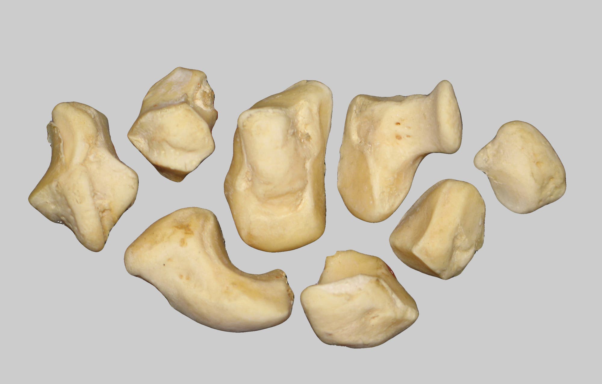 Handwurzelknochen, heiter - Spektrum der Wissenschaft